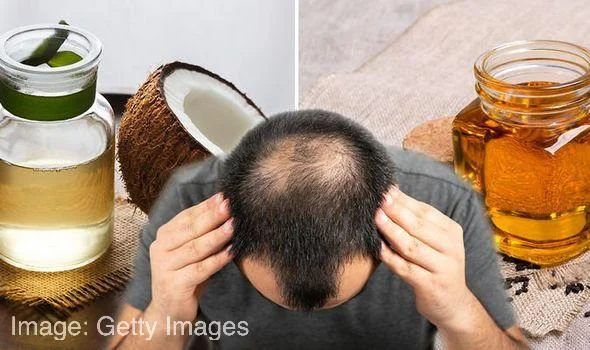 Temukan Rahasia Alami Manfaat Minyak Kelapa untuk Rambut Disini Temukan Rahasia Alami Manfaat Minyak Kelapa untuk Rambut Disini